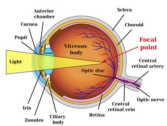 Ametropic Eye Model with CAD Lens in Zemax